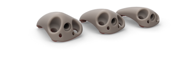 ZKR Orthopedics Performs First U.S. Patella Lift Procedure Initiating ...